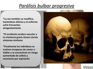 Síndrome de neurona motora superior e inferior | PPTX