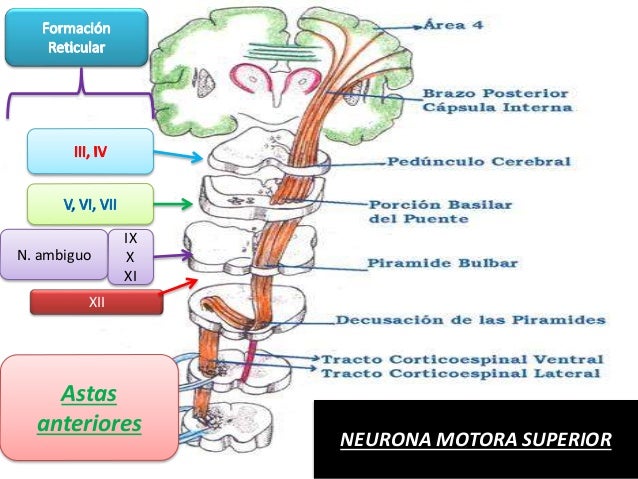 Síndrome de neurona motora superior e inferior