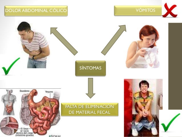 Síndrome de obstrucción intestinal