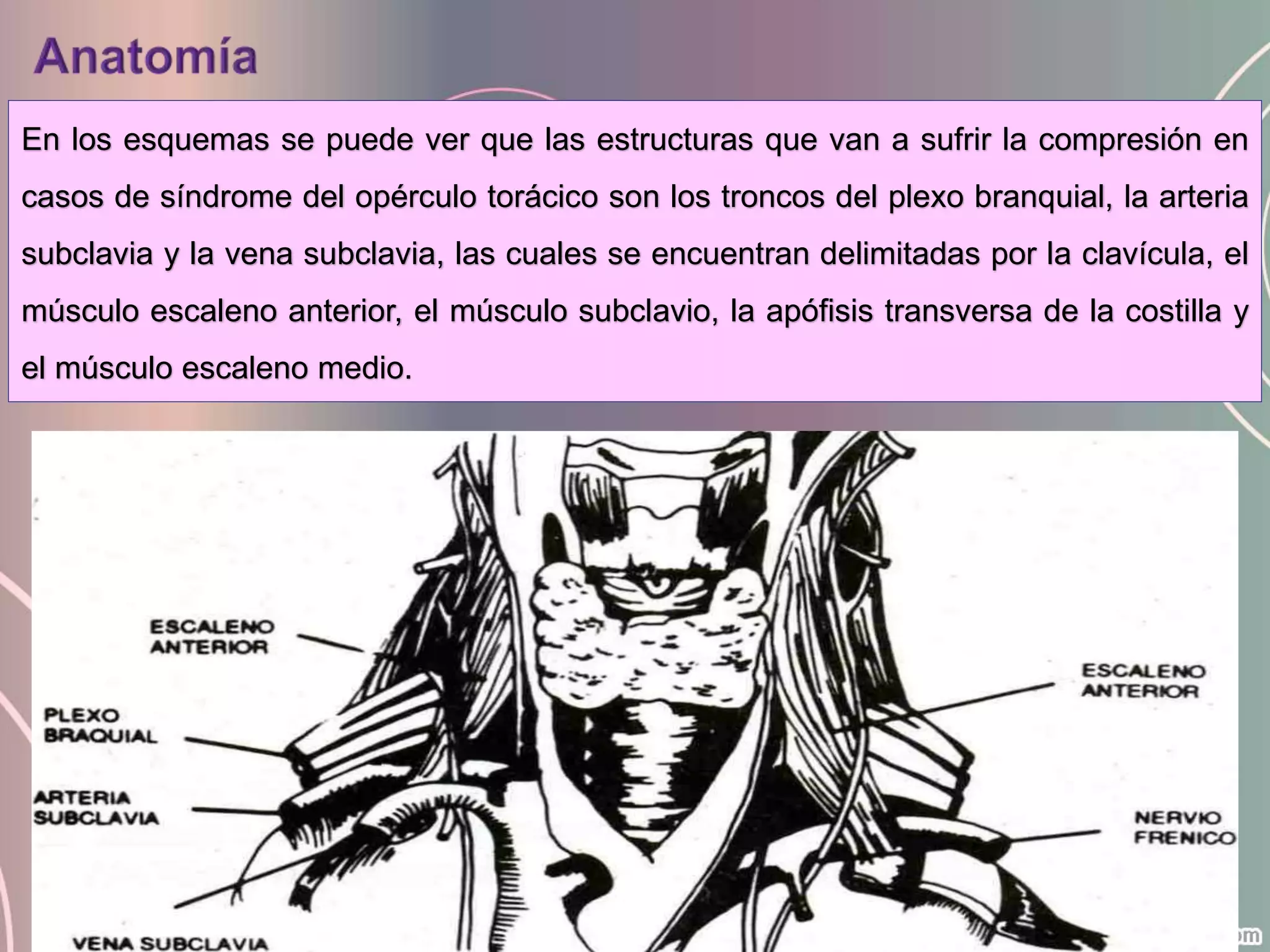 Síndrome de opérculo torácico y tratamiento en terapia ocupacional | PPT