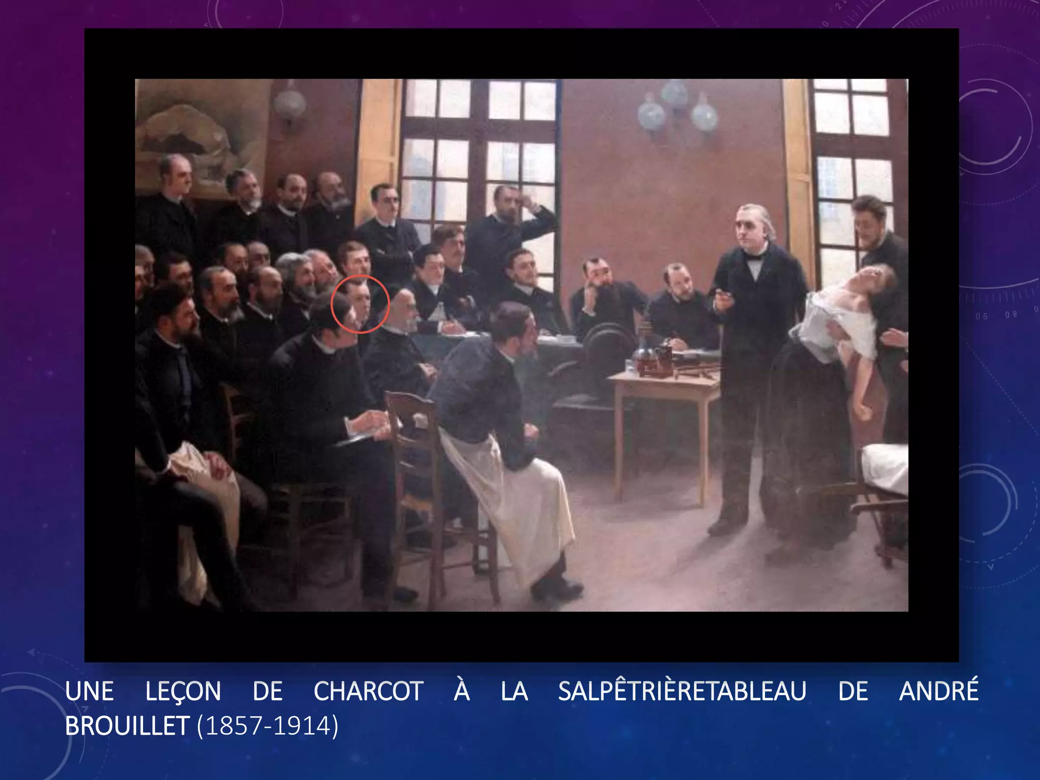 Síndrome de Parinaud | PPTX