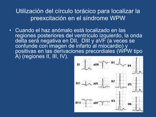 Síndrome de preexcitación | PPTX