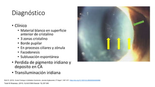Síndrome de pseudoexfoliación | PPTX