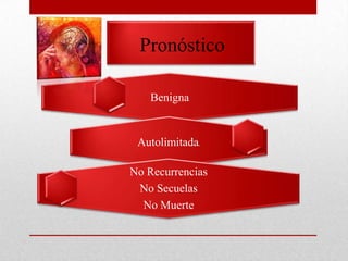 Síndrome de pseudomigraña con pleocitosis en lcr ( | PPTX