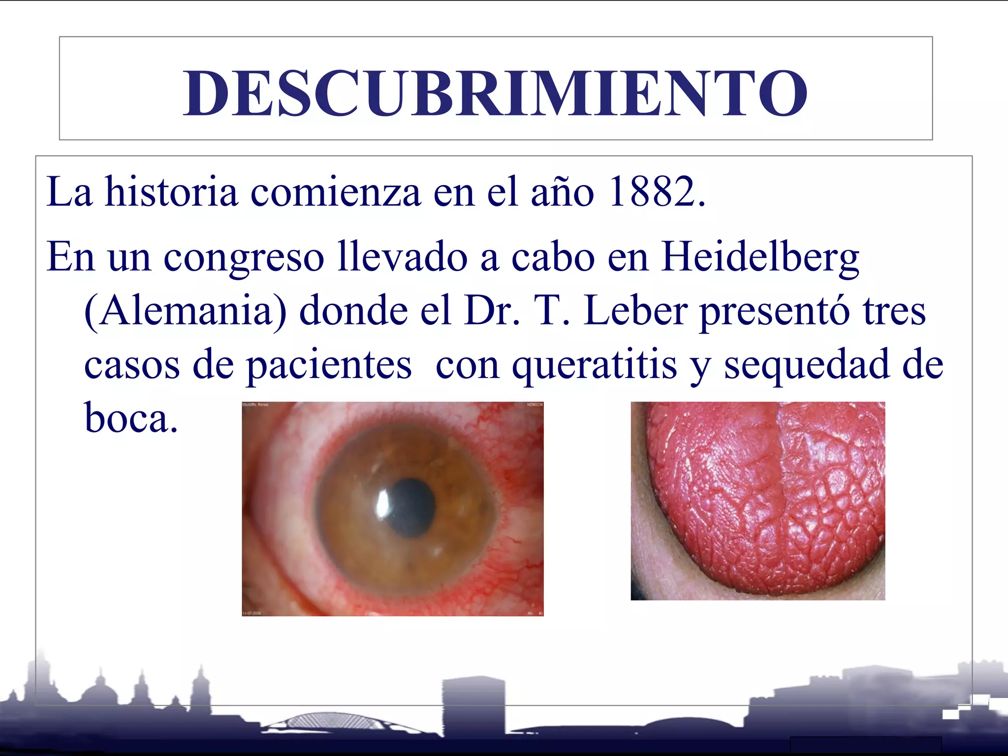Síndrome de sjôrgren | PPT