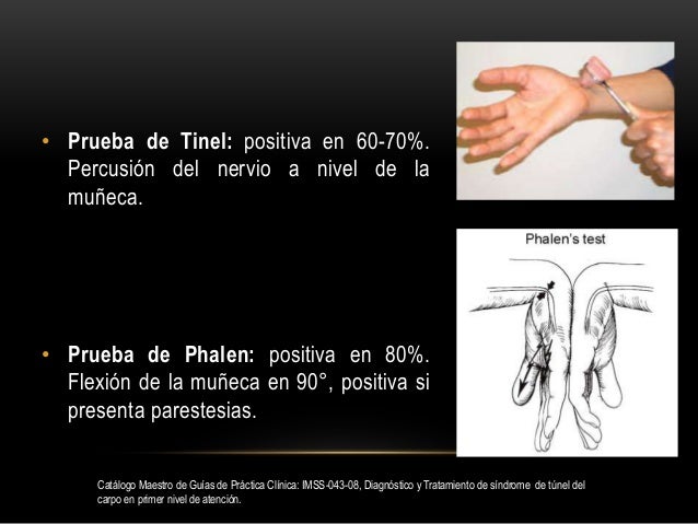 Síndrome de túnel del carpo y Espondiloartrosis cervical