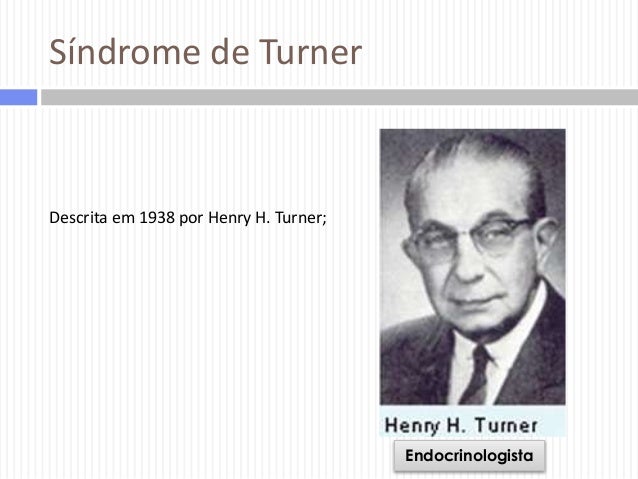Síndrome de Turner