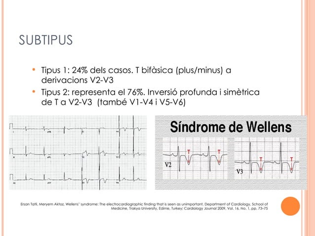 Síndrome de Wellens | PPT