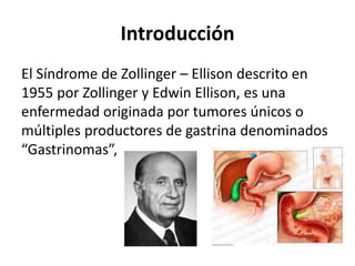 Síndrome de zollinger – ellison | PPTX