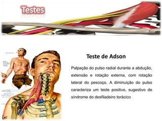 Síndrome do Desfiladeiro Torácico | PPTX