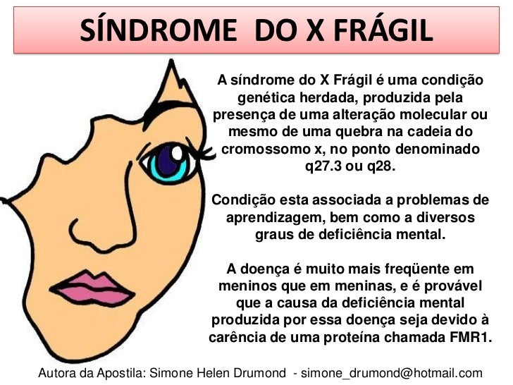 Síndrome do x frágil