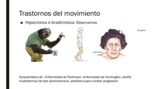 síndrome extrapiramidal, curso tercer año | PPTX