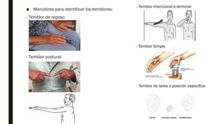 síndrome extrapiramidal, curso tercer año | PPTX