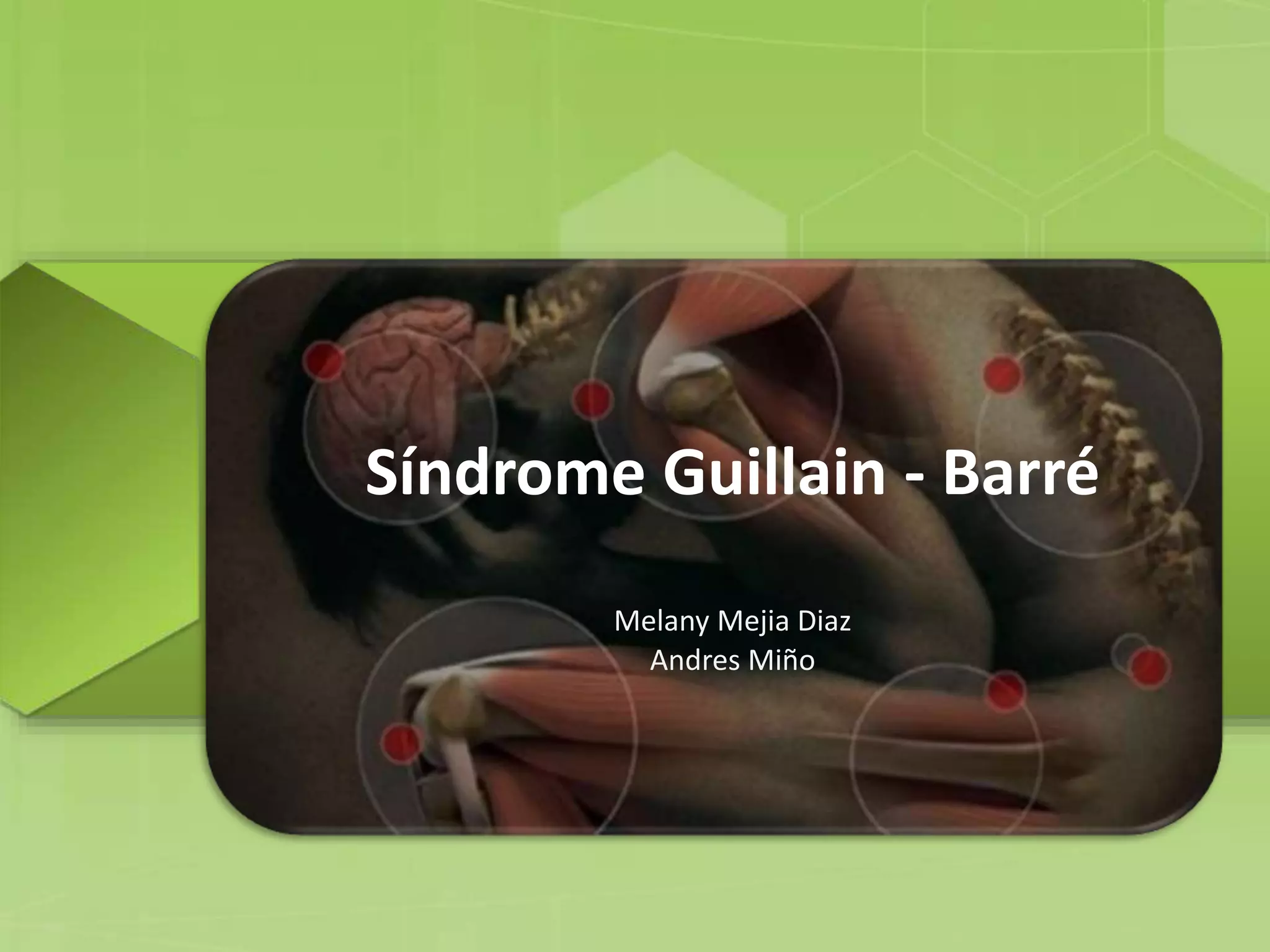 Síndrome guillain barré | PPTX