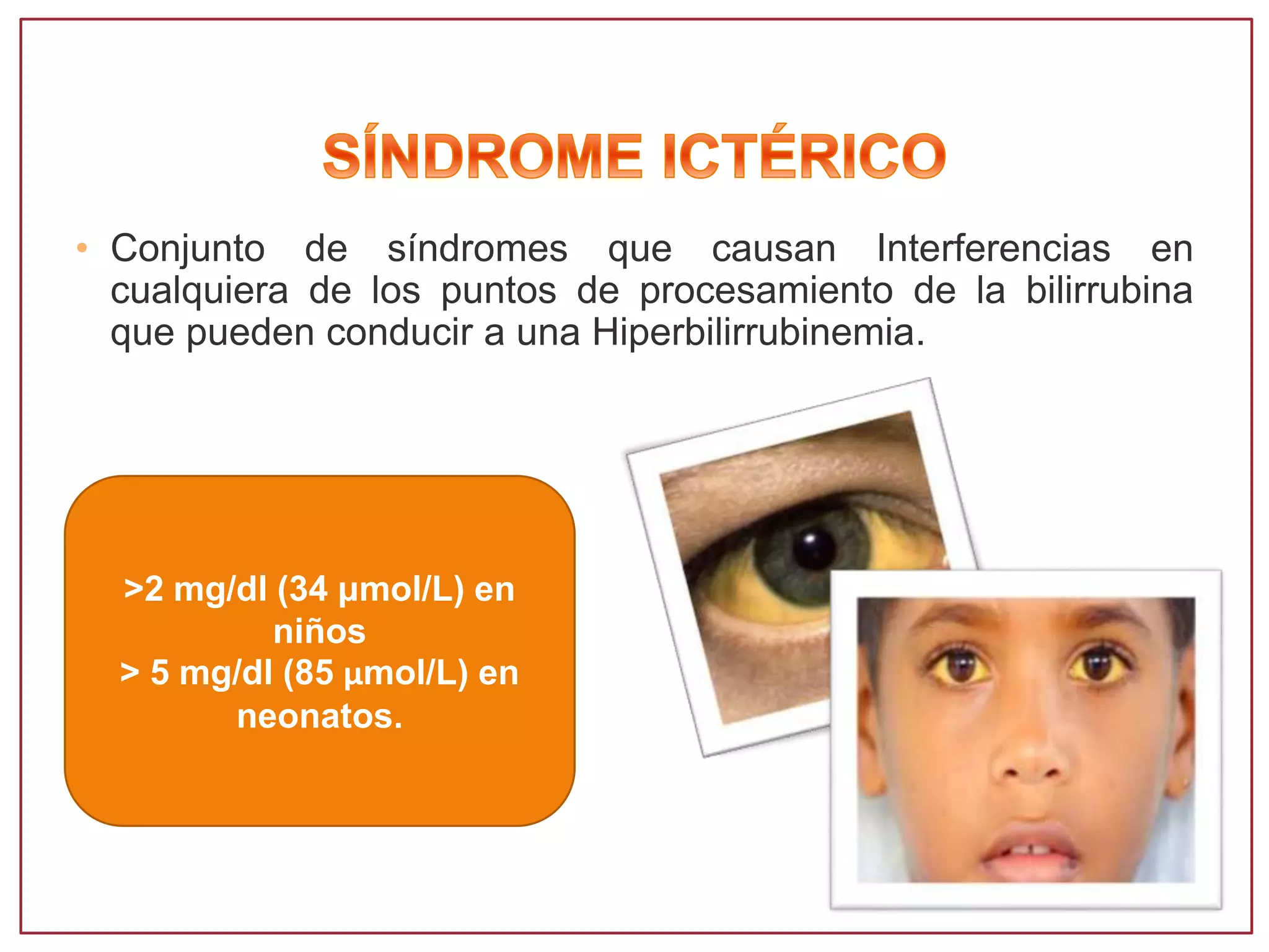 Síndrome que causan ictericia | PPSX