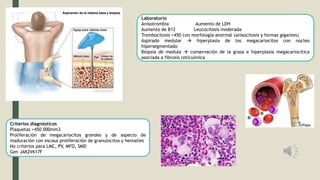 Síndrome mieloproliferativo en el adulto.pptx