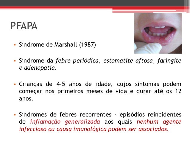 Síndrome pfapa e outras síndromes febris periódicas