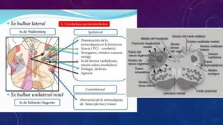 Síndromes bulbares Presentación en PDF.pptx