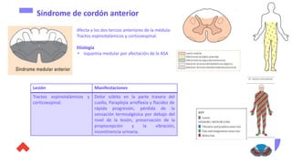 Síndromes Medulares .pdf