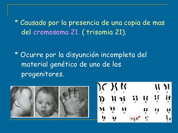 Síndromes más comunes de genética médica