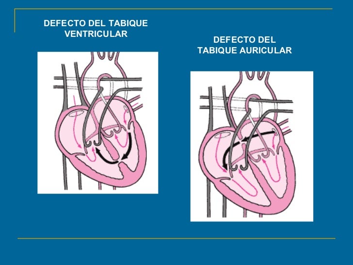 Síndromes más comunes de genética médica