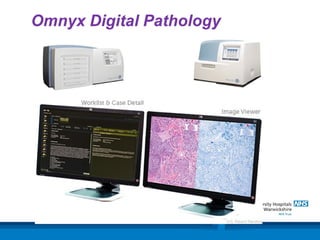 David Snead on The use of digital pathology in the primary diagnosis of ...