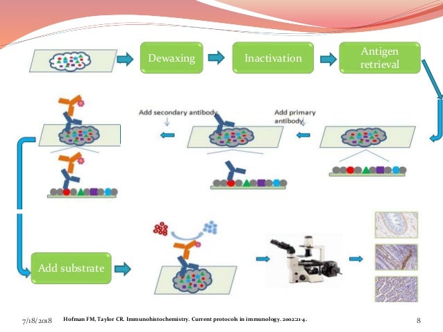 immunohistochemistry