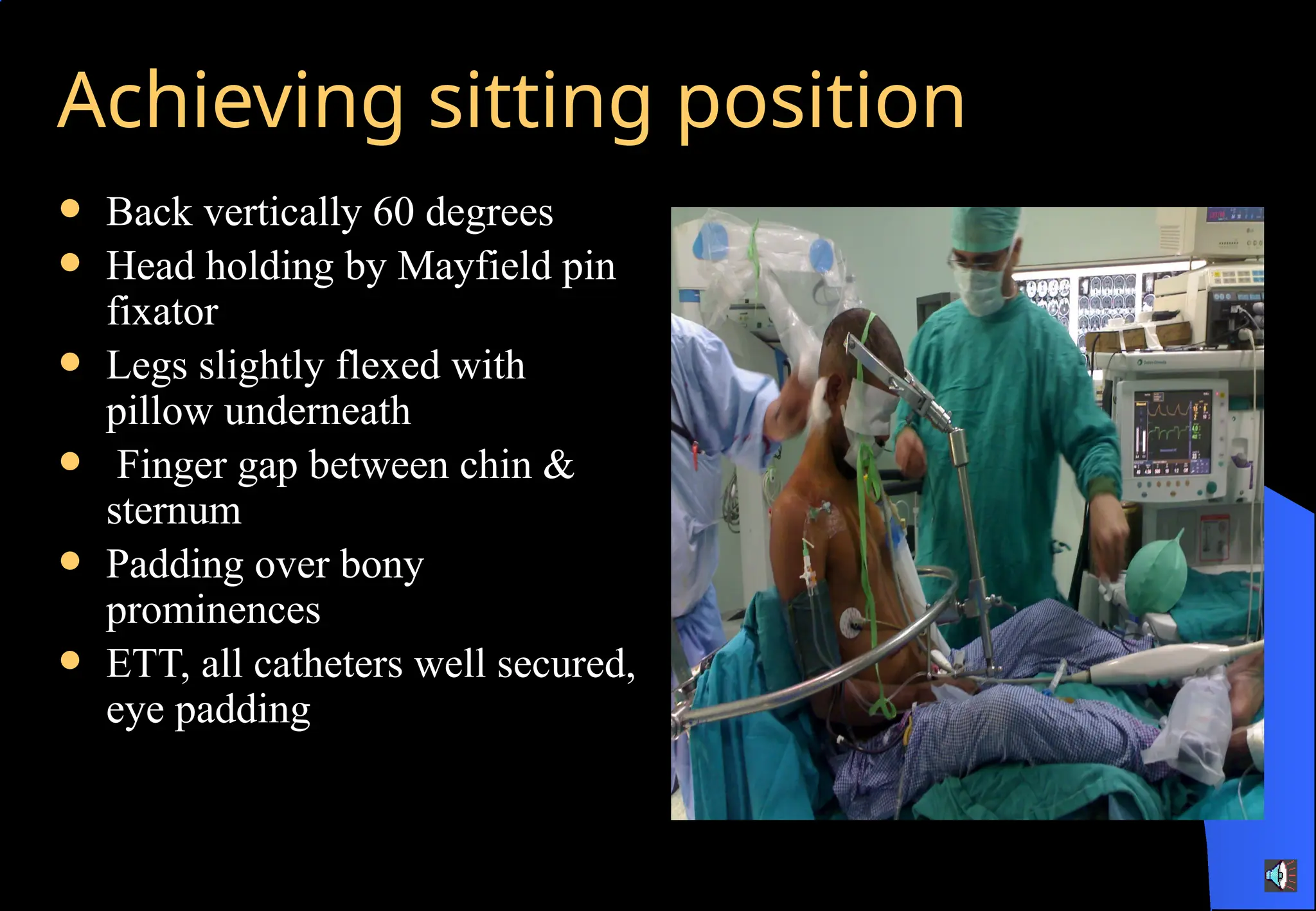 Posterior fossa tumors, anesthesia management and special problem | PPTX