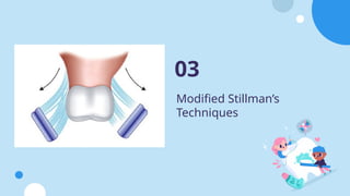 Sneha_Tiwari_Perio Seminar senha ppt.pptx