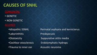 SNHL compiled by BIJAY BHATTARAI | PPTX