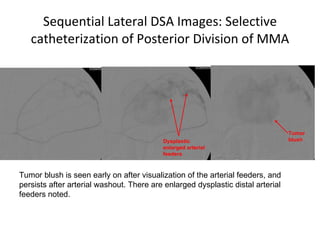 Harbor UCLA Neuro-Radiology — Case 4 | PPT