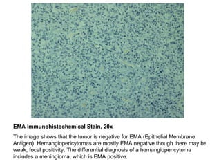 Harbor UCLA Neuro-Radiology — Case 4 | PPT