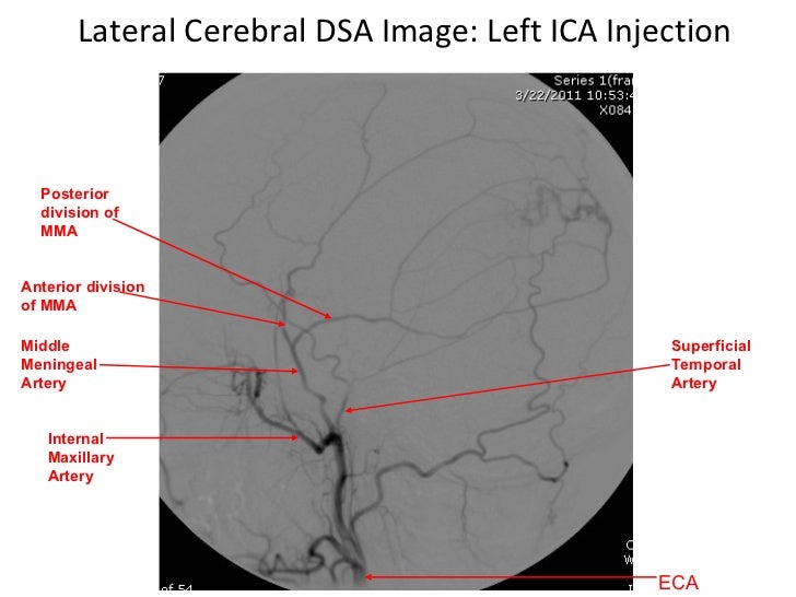 Harbor UCLA Neuro-Radiology — Case 4
