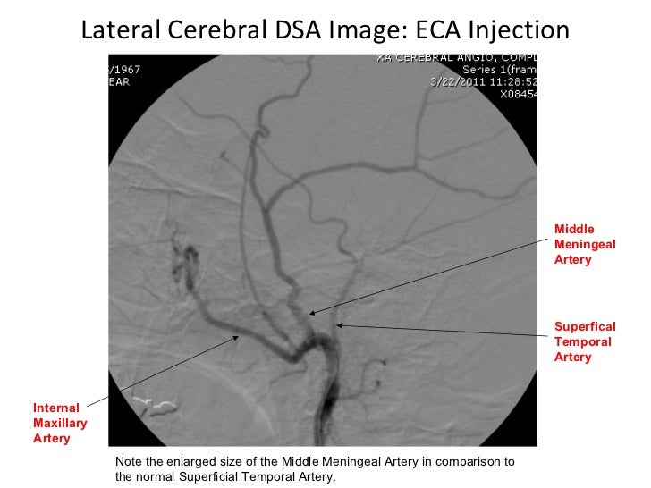 Harbor UCLA Neuro-Radiology — Case 4