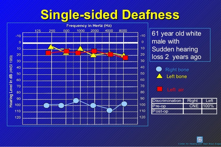 Devices to help you hear