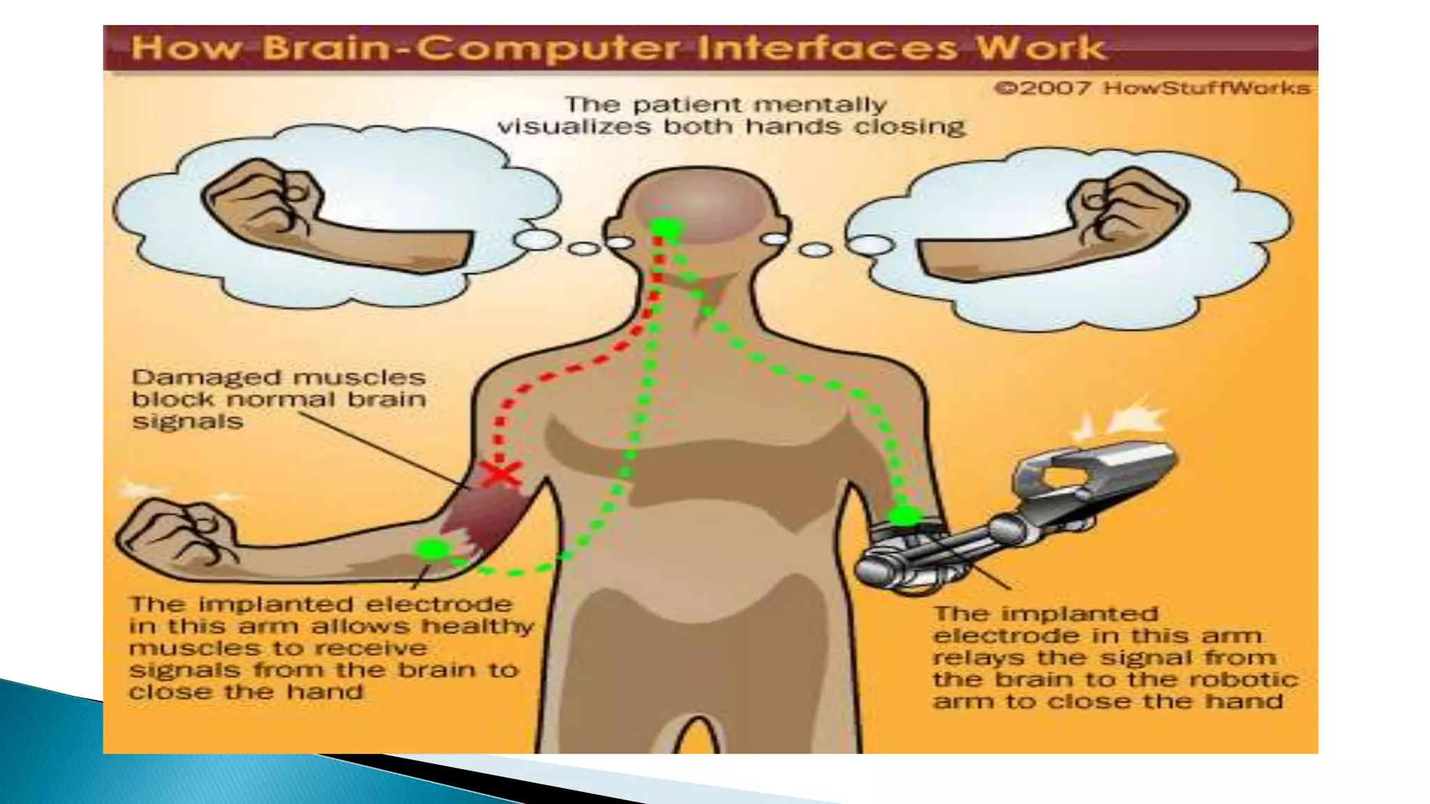 Brain Computer Interface | PPT
