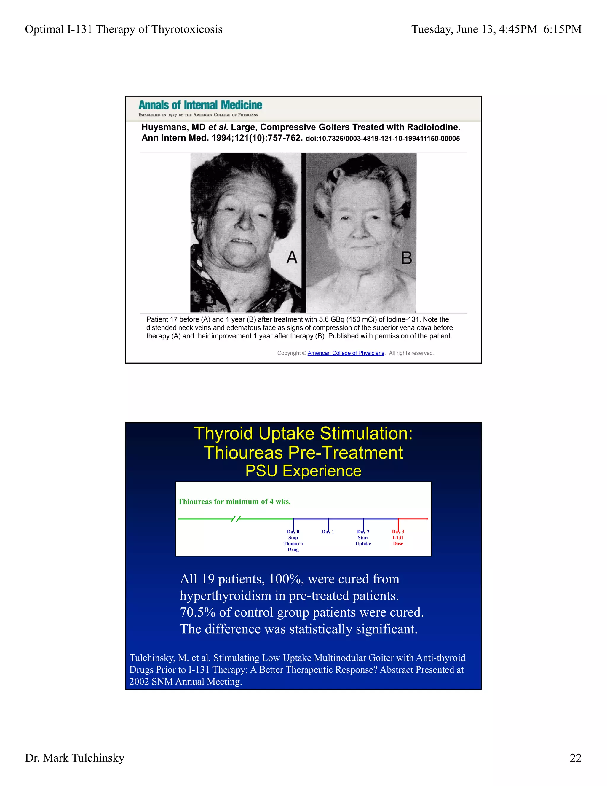 Optimal I-131 Therapy of Thyrotoxicosis | PDF