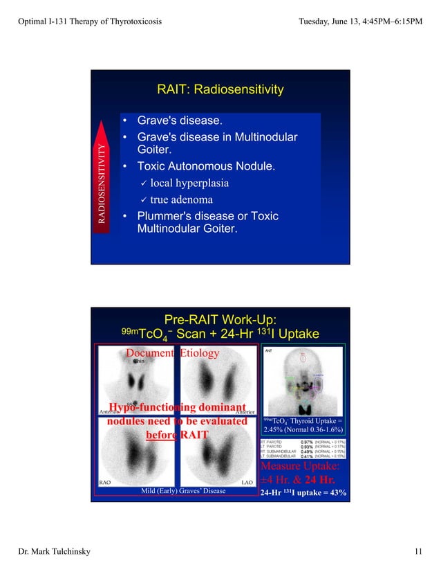 Optimal I-131 Therapy of Thyrotoxicosis | PDF