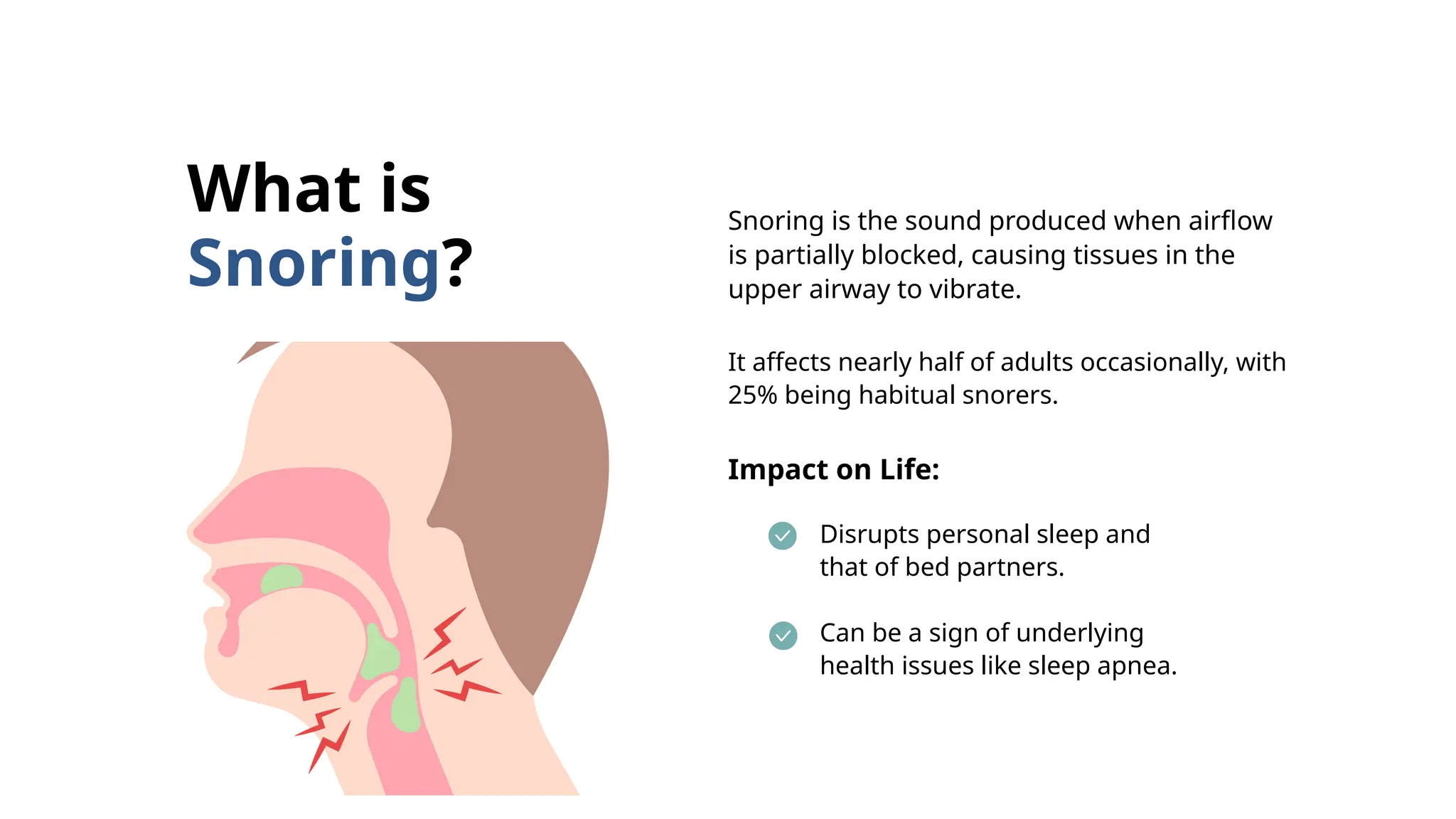 Snoring - Causes, Role of Sleeping Positions and Remedies | PPTX