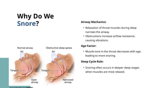 Snoring - Causes, Role of Sleeping Positions and Remedies | PPTX