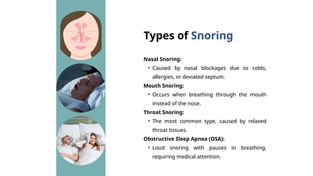 Snoring - Causes, Role of Sleeping Positions and Remedies | PPTX