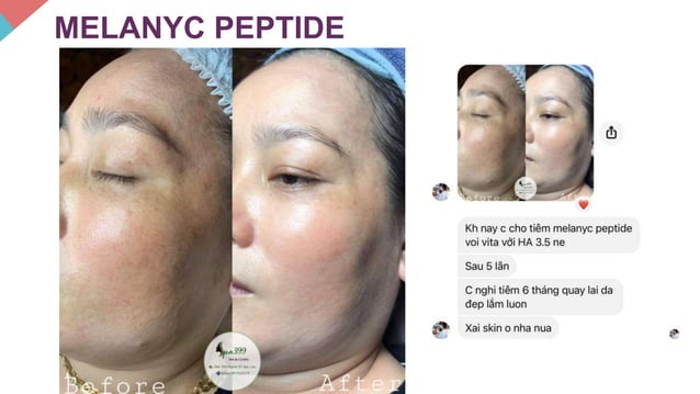 Sản phẩm tiêm Meso từ thương hiệu Skinclinic | PPTX