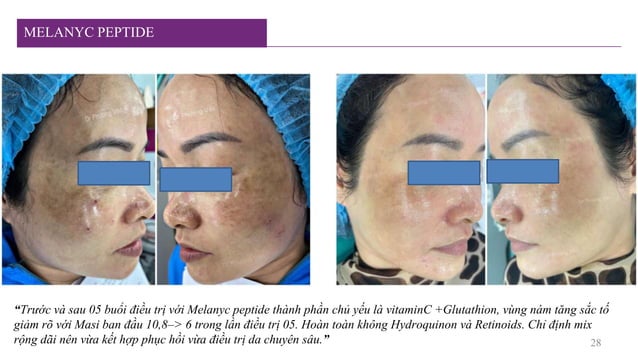 Sản phẩm tiêm Meso từ thương hiệu Skinclinic | PPTX