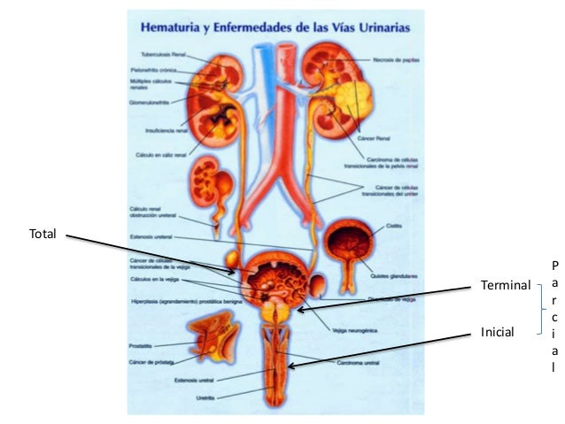 Síntomas del sistema genitourinario