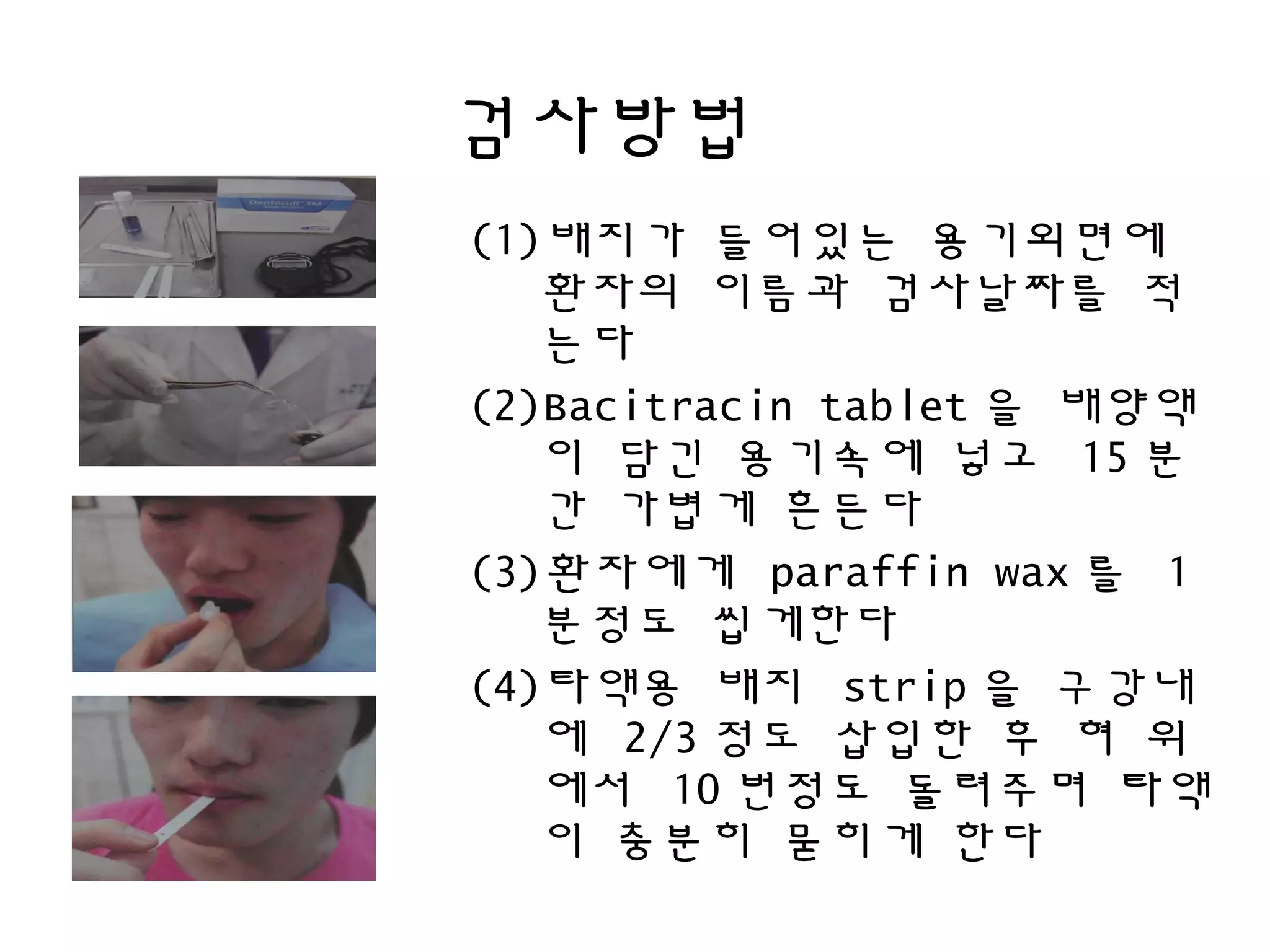 Snyder test&alban test&s mutans screening&타액분비능검사 | PPT