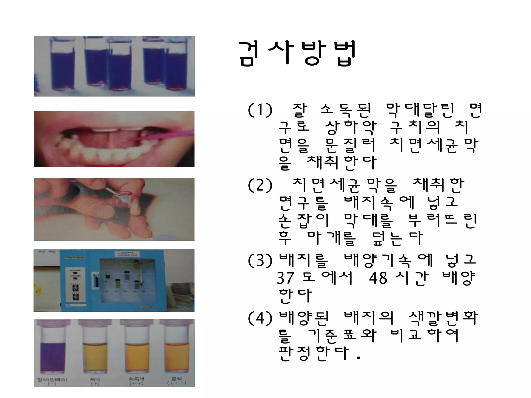 Snyder test&alban test&s mutans screening&타액분비능검사 | PPT