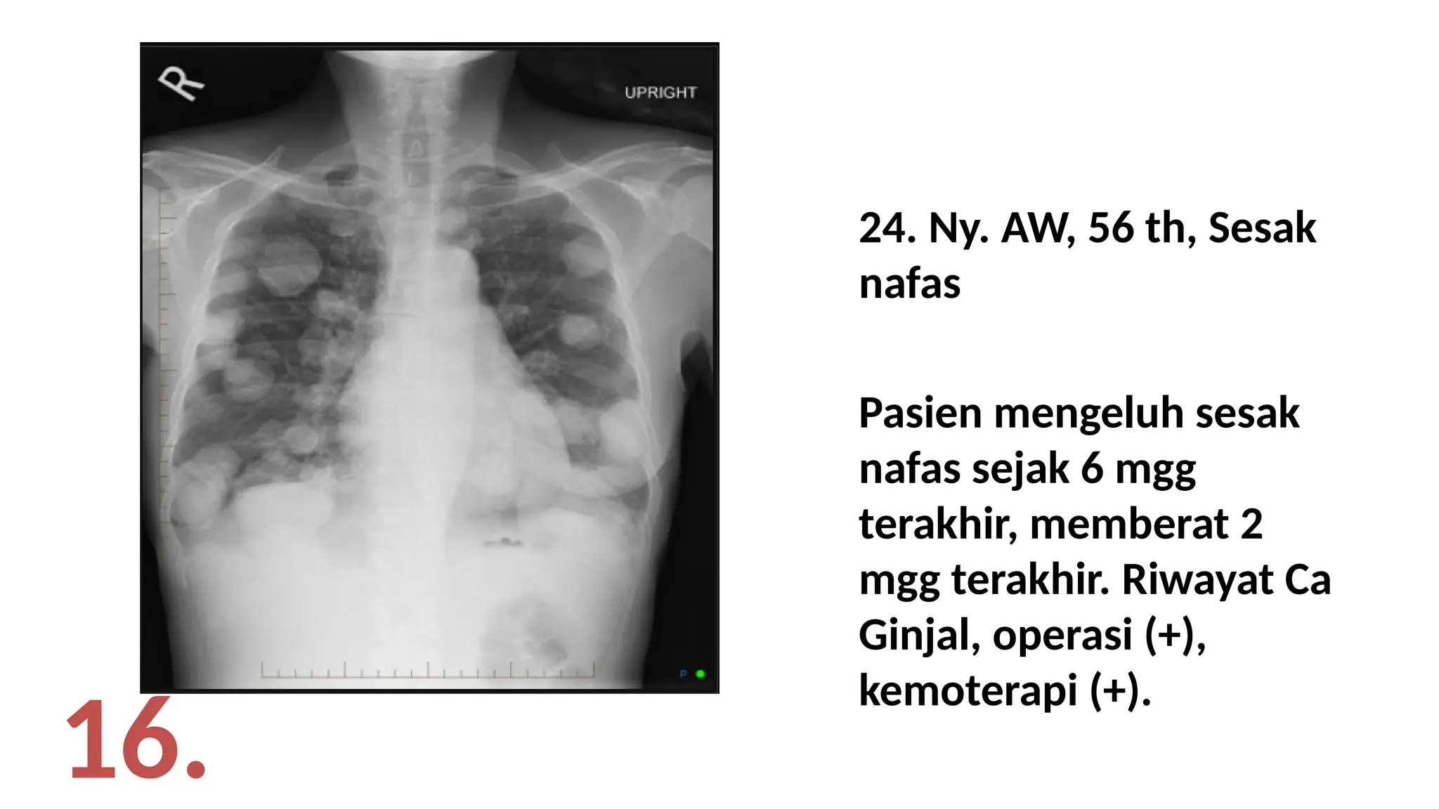 Contoh Soal-Soal Koas Radiologi Matrikulasi | PPTX