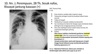 Contoh Soal-Soal Koas Radiologi Matrikulasi | PPTX