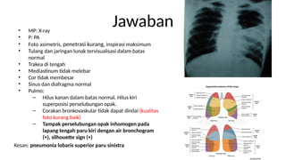 Contoh Soal-Soal Koas Radiologi Matrikulasi | PPTX