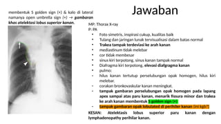 Contoh Soal-Soal Koas Radiologi Matrikulasi | PPTX